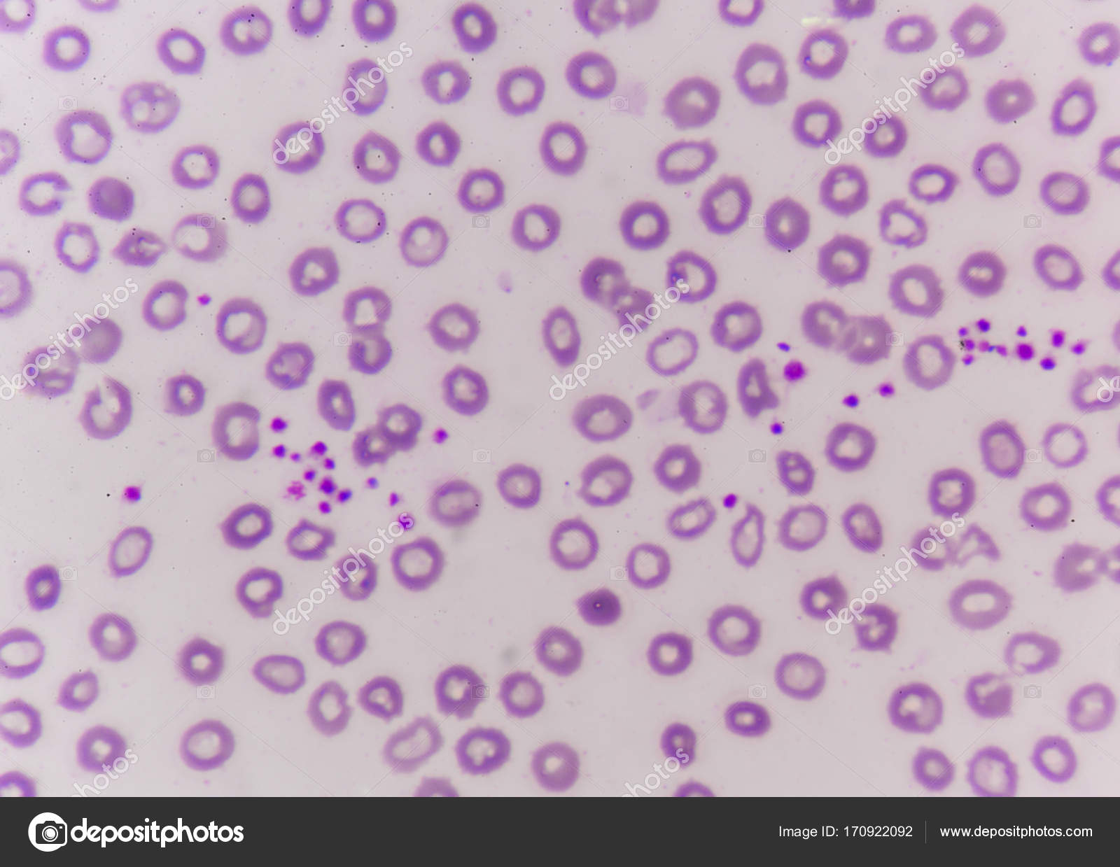 Platelets Under Microscope
