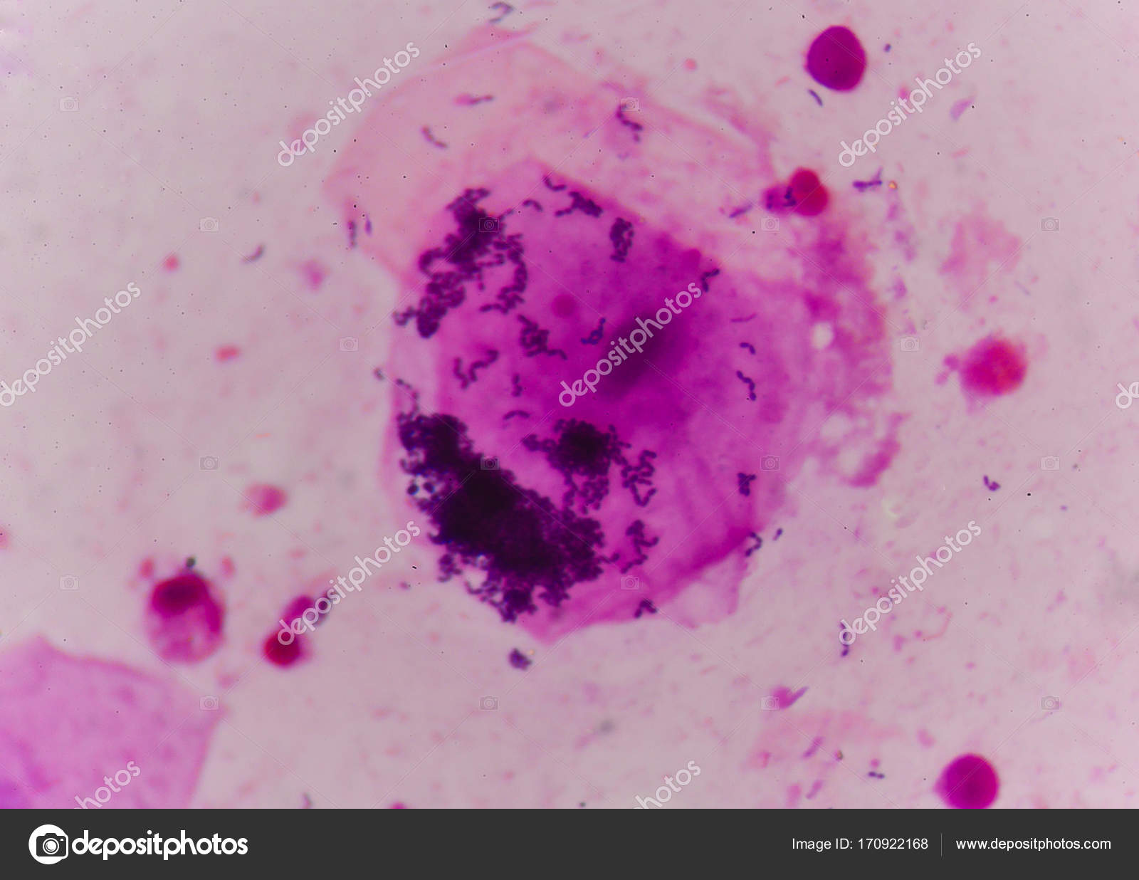 Bacteria cell in gram stain method. — Stock Photo © toeytoey #170922168