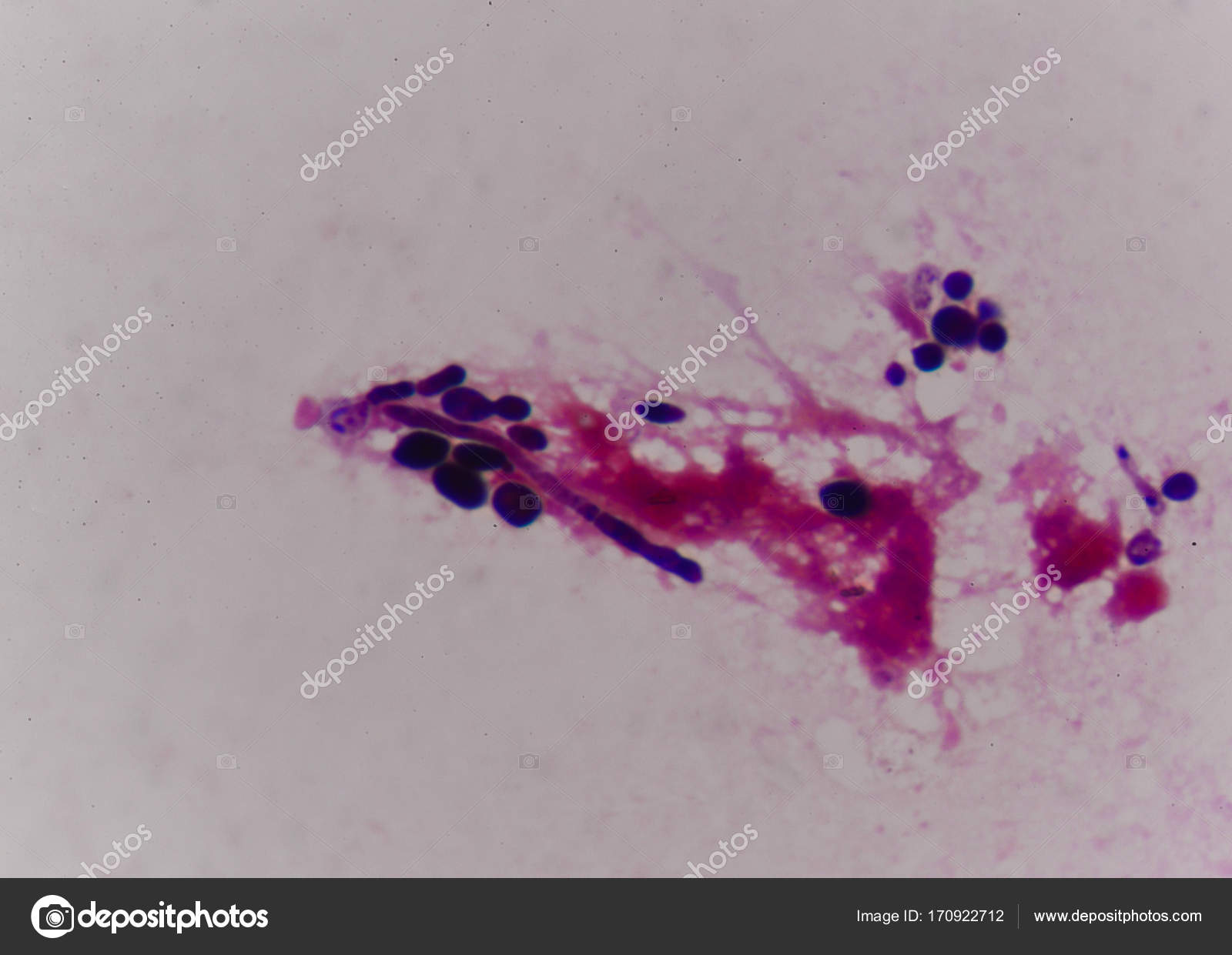 Budding yeast cell in gram stain method. — Stock Photo © toeytoey ...