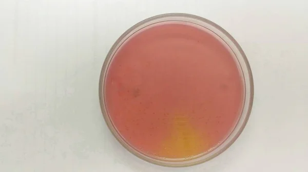 Close up agar plate and biochem test. - Stock Image - Everypixel