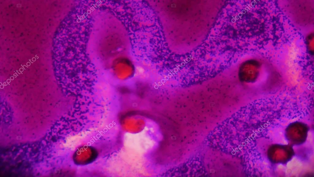 Fondo anormal de las c lulas sangu neas. 2024