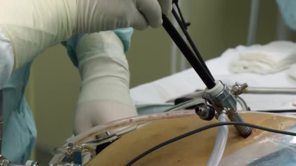 Abdominal laparoscopy in operating room close-up. — Stock Video ...