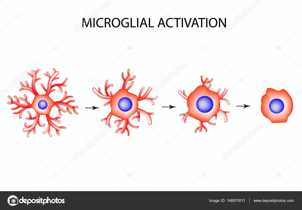 Activación de microglía. Neurón. Celda nerviosa. Infografías ...