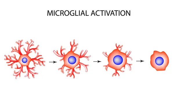 The structure of microglia. Neuron. Nerve cell. Infographics. Vector ...