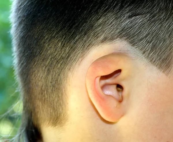 Deformed ear. Abnormal development of the auricle. Plastic surgery and ...