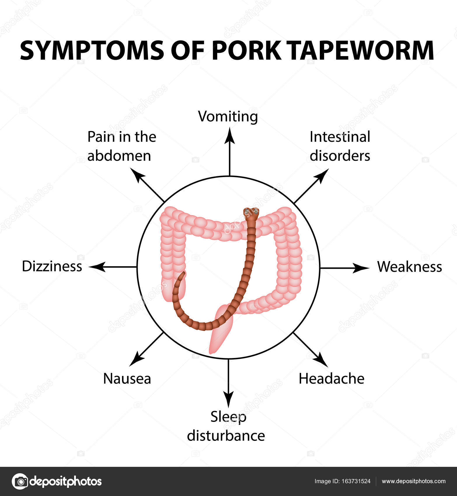 Tapeworm Labeled