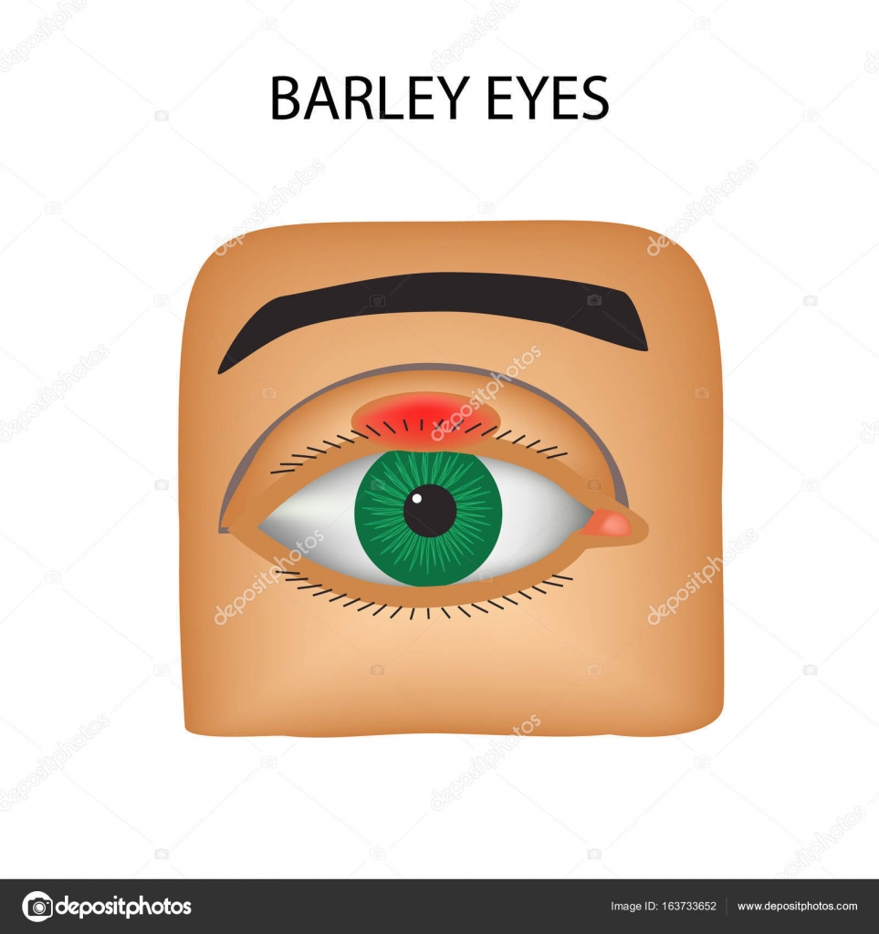 Barley eyes. Purulent inflammation. The structure of the eye ...