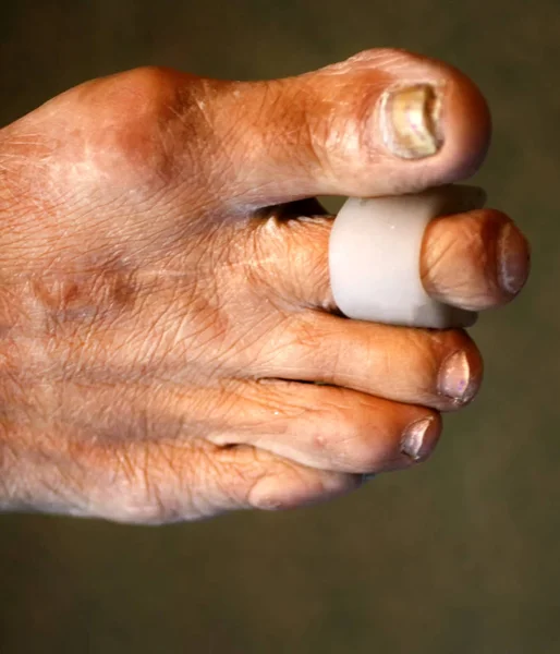 1,598 Foot corn Stock Photos | Free & Royalty-free Foot corn Images ...