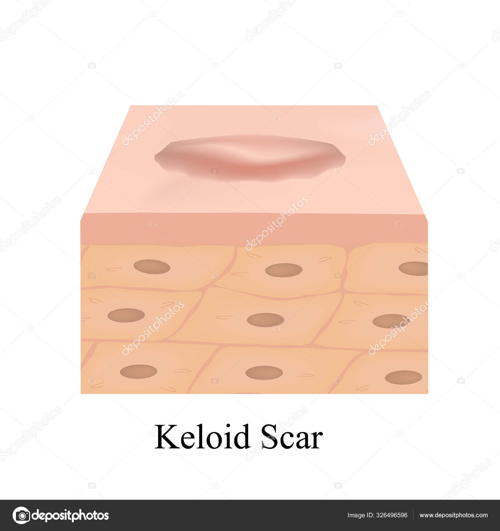 Cartoon Skinscar