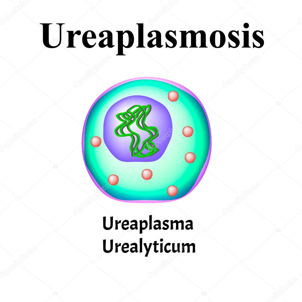 Ureaplasma urealyticum. Infecciones bacterianas Ureaplasma ...