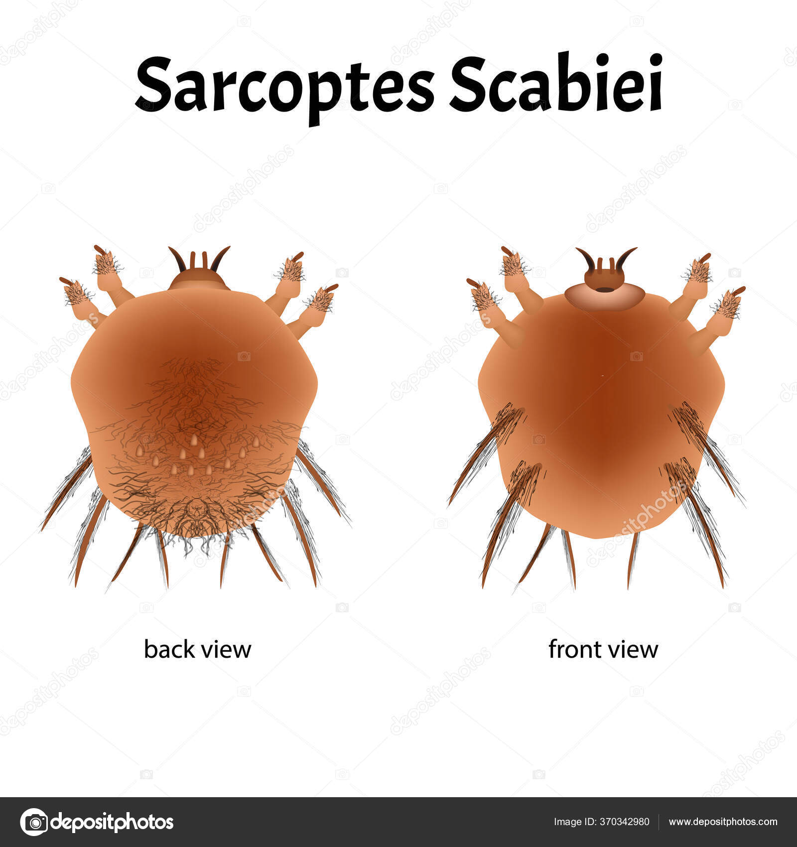 Sarcoptes scabiei. scabies. Sexually transmitted disease. Infographics ...