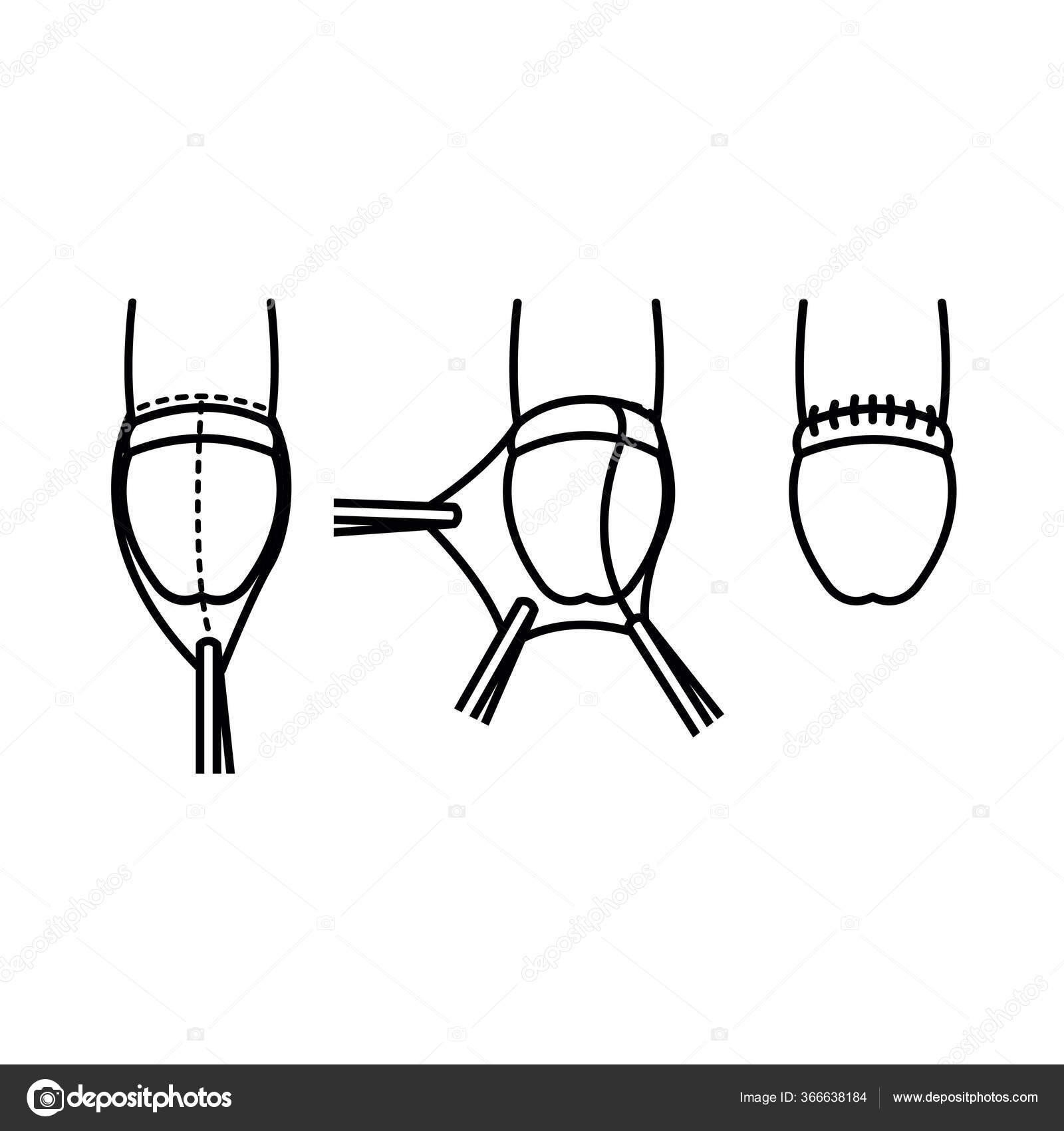 Icono Línea Circuncisión Ilustración Simple Vector — Vector de stock ...
