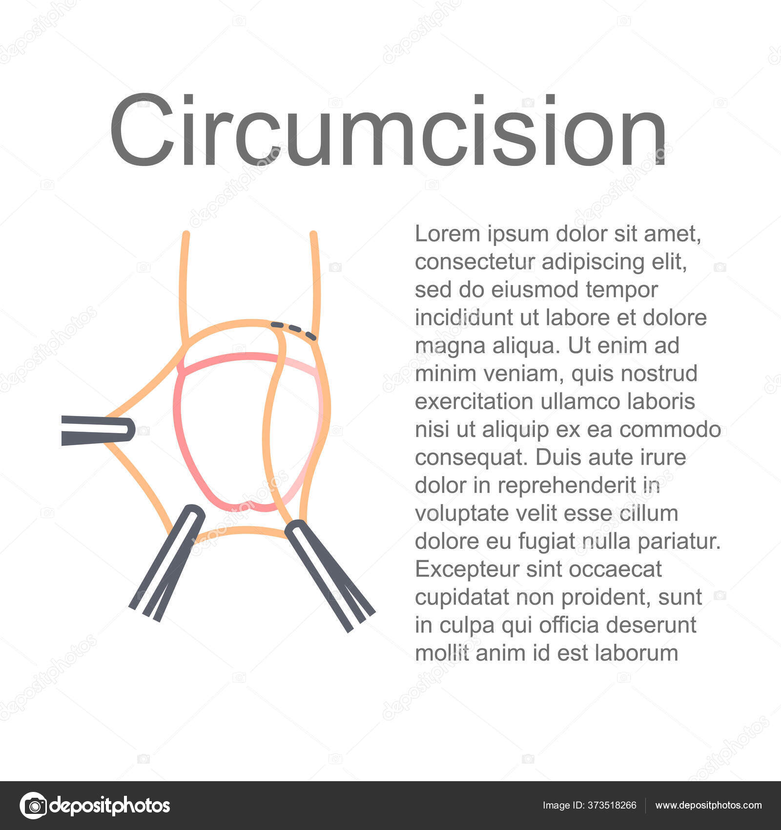 Icono Línea Circuncisión Ilustración Simple Vector — Vector de stock ...