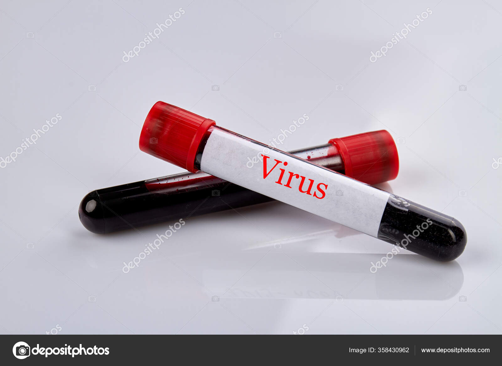 Blood test tubes with virus samples. — Stock Photo © Denisfilm #358430962