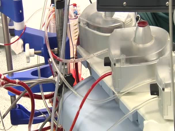 Working Heart-Lung Bypass Machine. Surgery in modern operating room ...