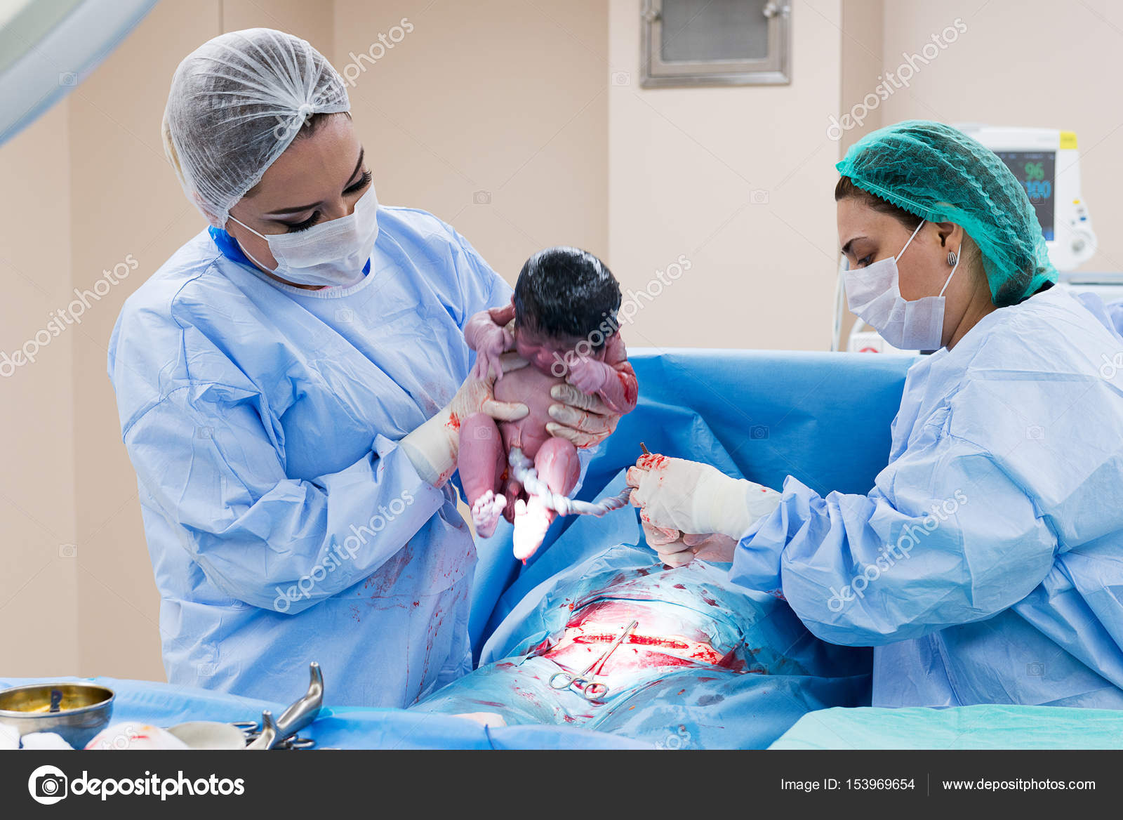 Surgical team performing surgery operation. Doctor performing s Stock ...