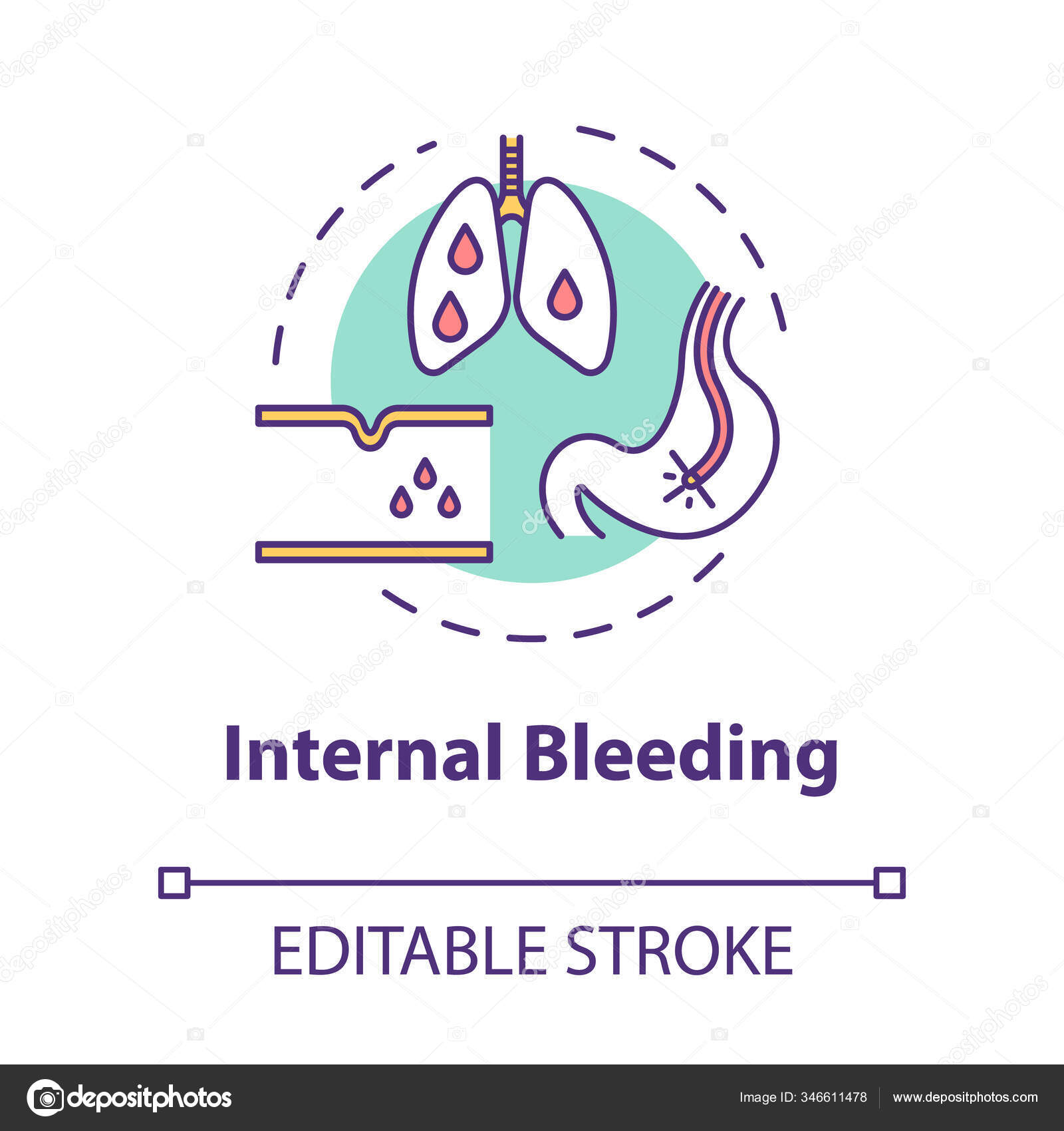 Internal Bleeding Diagram