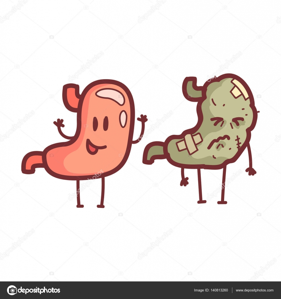 Gyomor emberi belső szerv egészséges Vs egészségtelen, orvosi anatómiai ...