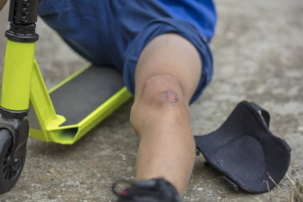 Rodilla raspada fotos de stock, imágenes de Rodilla raspada sin ...