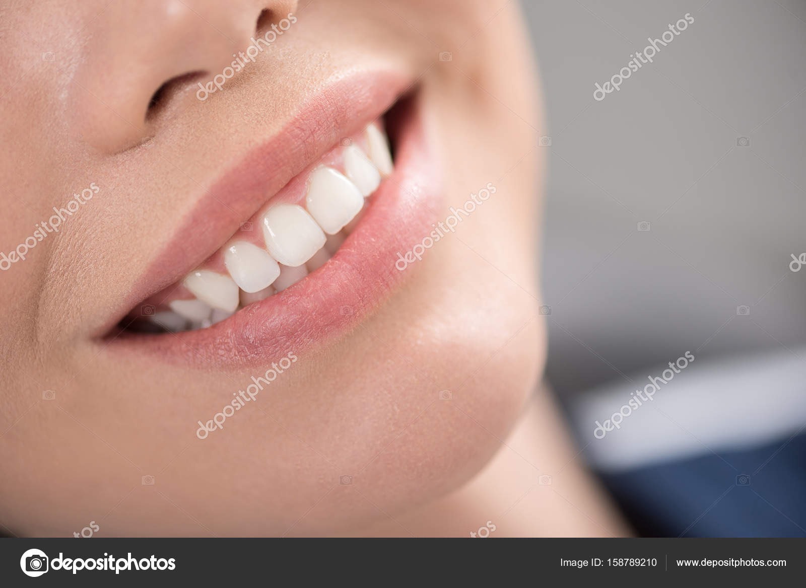 Cheerful smile with brilliant teeth — Stock Photo © iakovenko123 #158789210