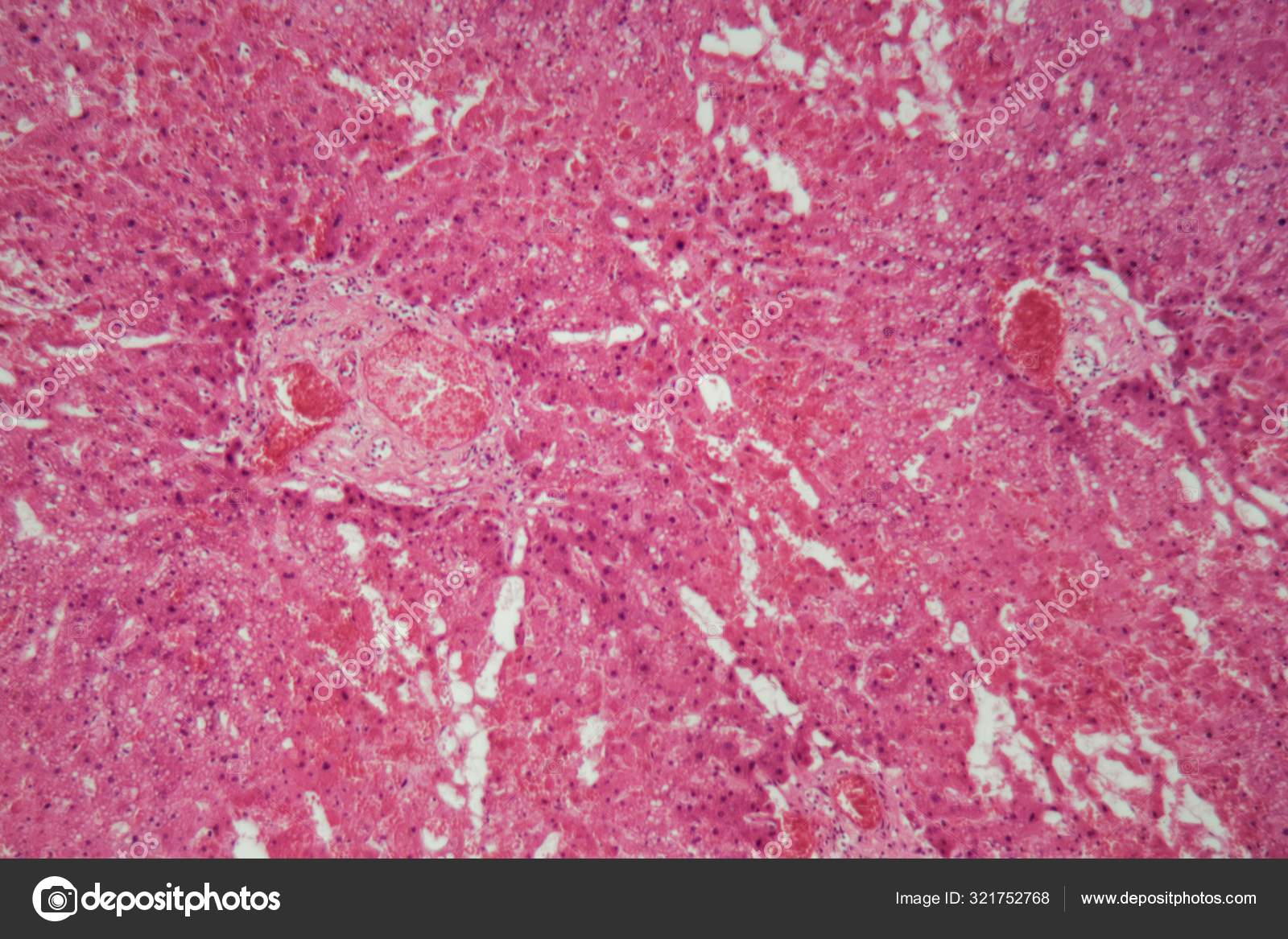 Human Liver Cells Under Microscope