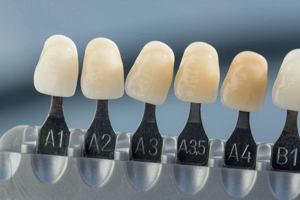 Shade guide Stock Photos, Royalty Free Shade guide Images | Depositphotos