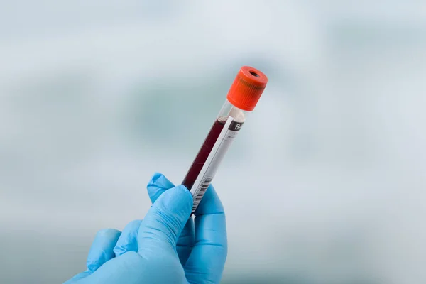 Hand holding a blood probe Stock Photo by ©StudioLaMagica 164041762