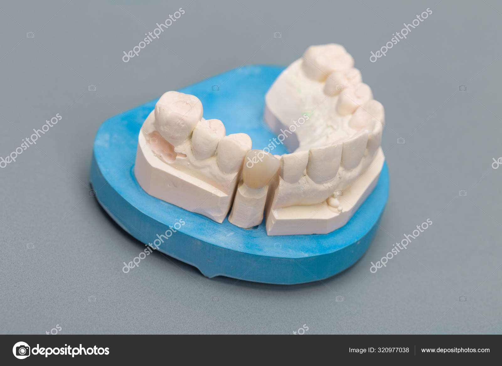 Dental Imprint Artificial Dentition Dental Laboratory Ready Use Stock ... Dental Imprint Artificial Dentition Dental Laboratory Ready Use Stock ...