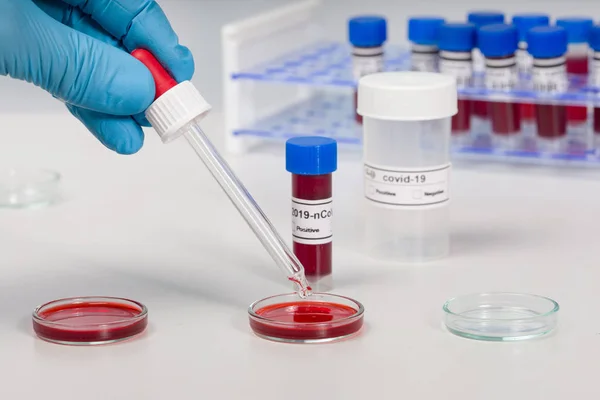 Manejo de sondas para analizar si hay coronavirus en un laboratorio 2023