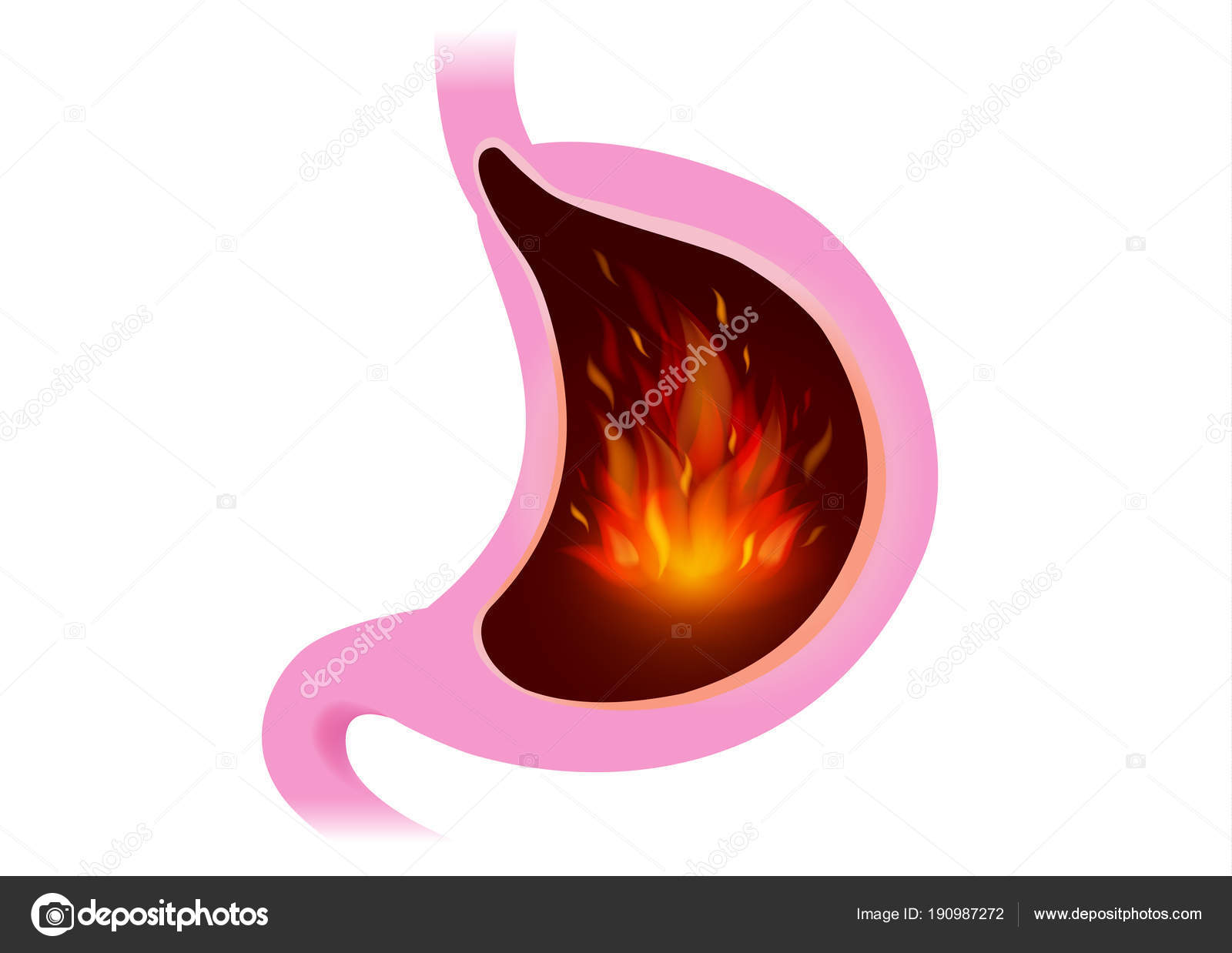 Fire Stomach Isolated White Illustration Felling People Burning ...