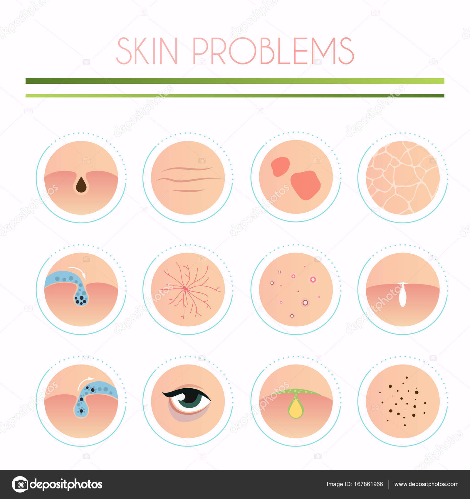 Skin problems solution, home remedies — Stock Vector © Gapchuk_Olesia ...
