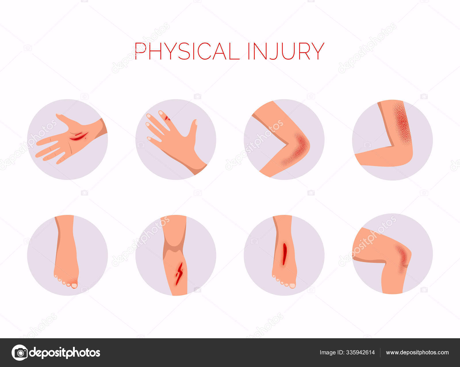 Human Body Physical Injury Flat Set Open Cut Wounds Elbow Stock Vector ...