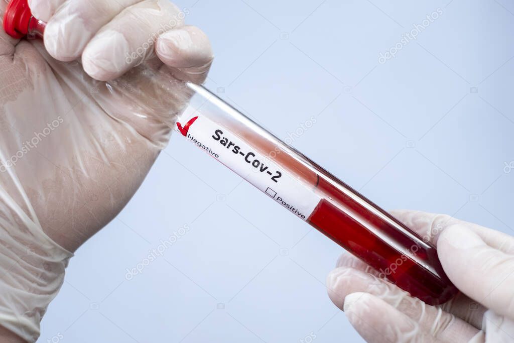 El virólogo sostiene un tubo de ensayo con una muestra de sangre ... El virólogo sostiene un tubo de ensayo con una muestra de sangre ...