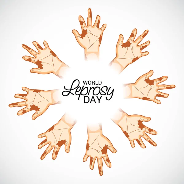 Vector Illustration Background World Leprosy Day Stock Vector Image by ...