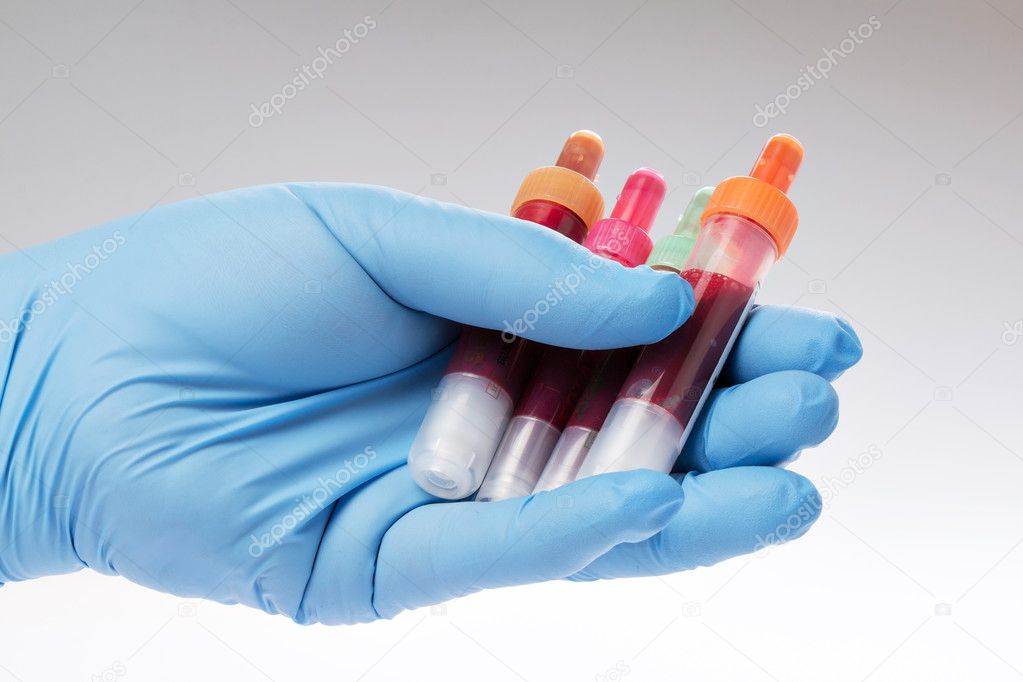 Blood test, blood samples on a laboratory form — Stock Photo ...