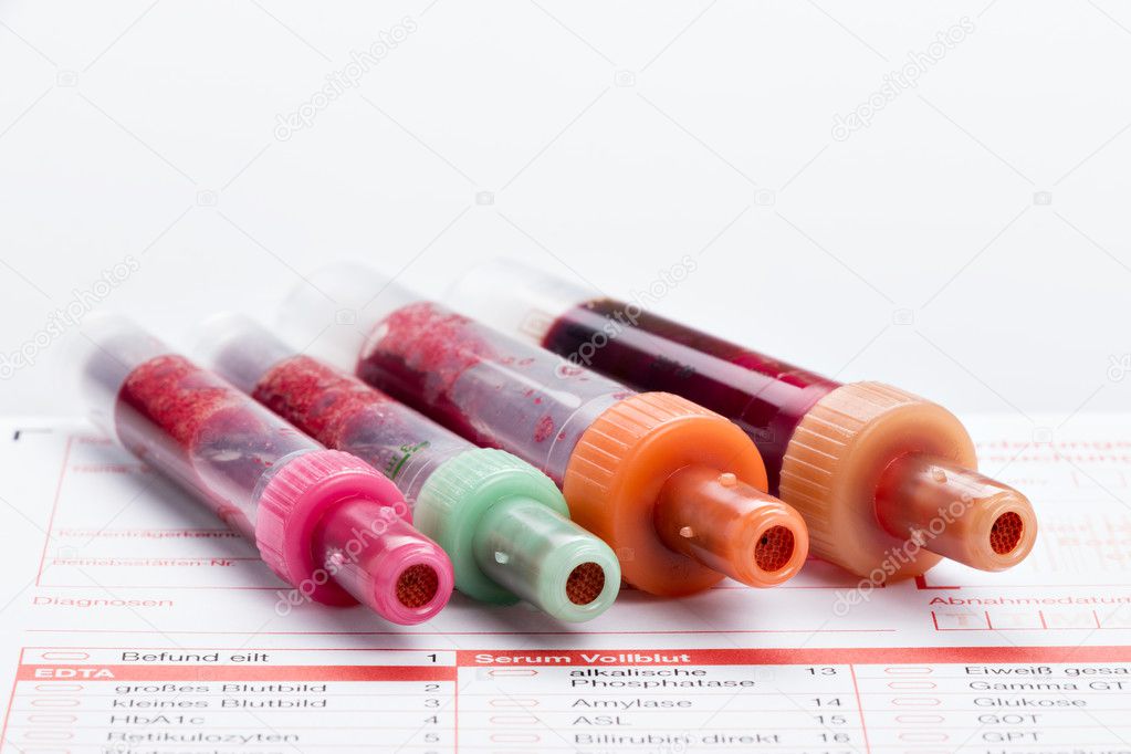 Blood test, blood samples on a laboratory form Stock Photo by ...