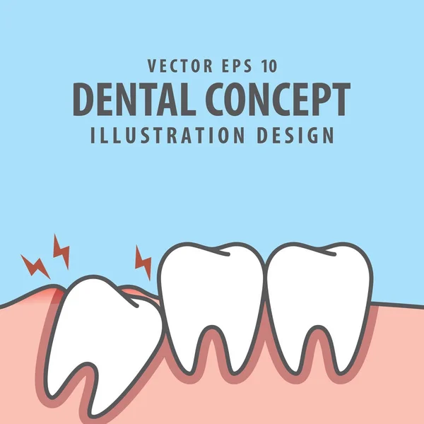 Wisdom teeth impaction Vector Art Stock Images | Depositphotos