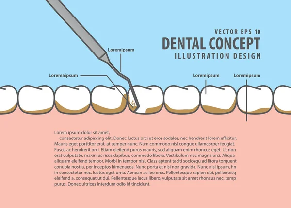 Dental scaling Vector Art Stock Images | Depositphotos