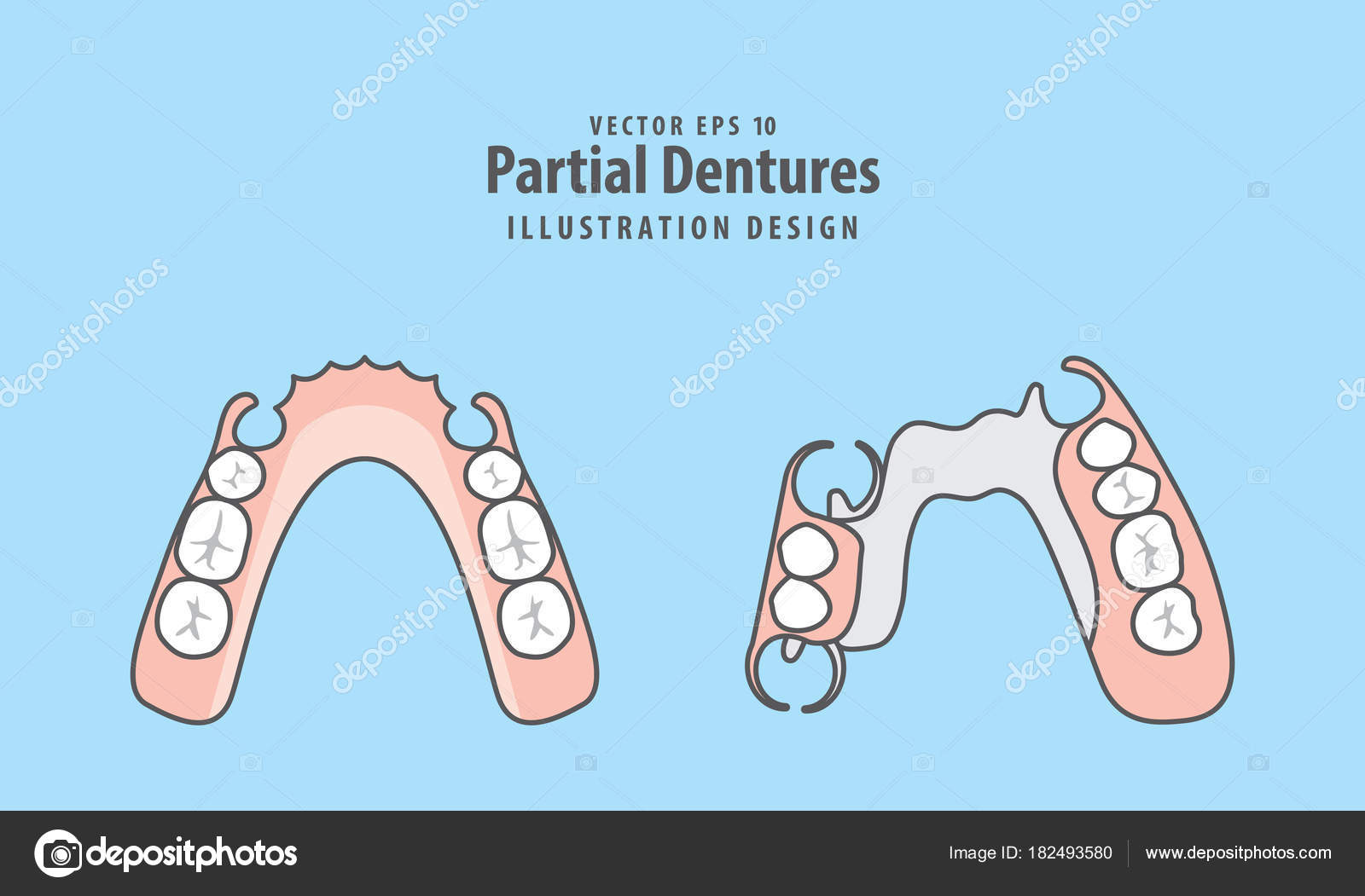 Partial Dentures illustration vector on blue background. Dental Stock ...