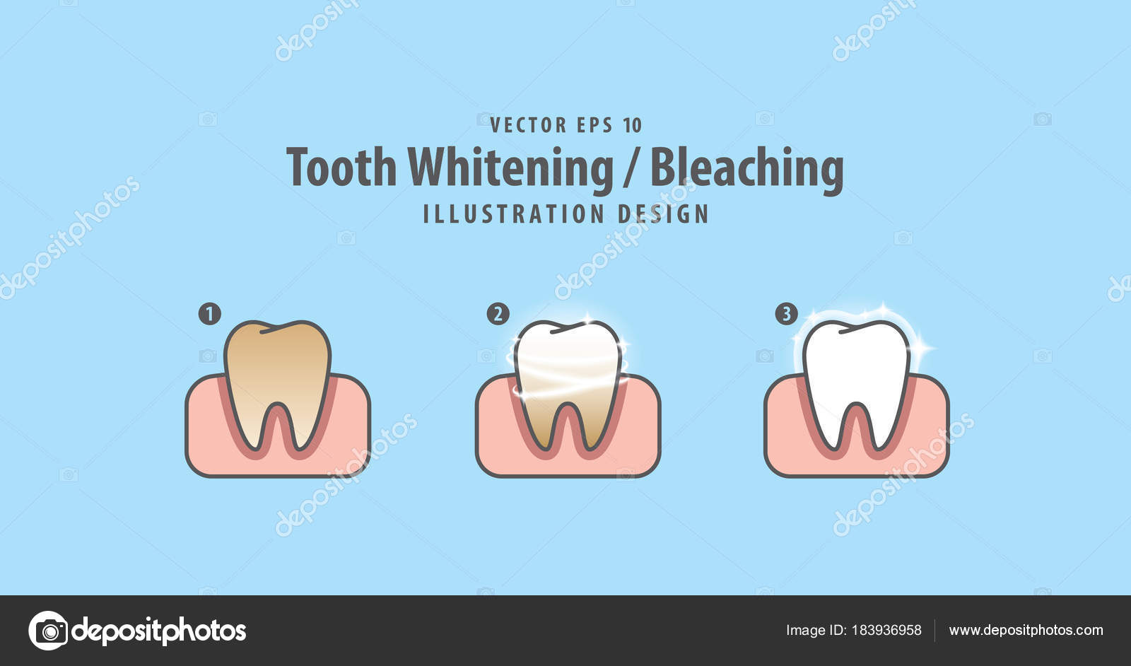 Step of single tooth Whitening-Bleaching and human gum illustrat Stock ...