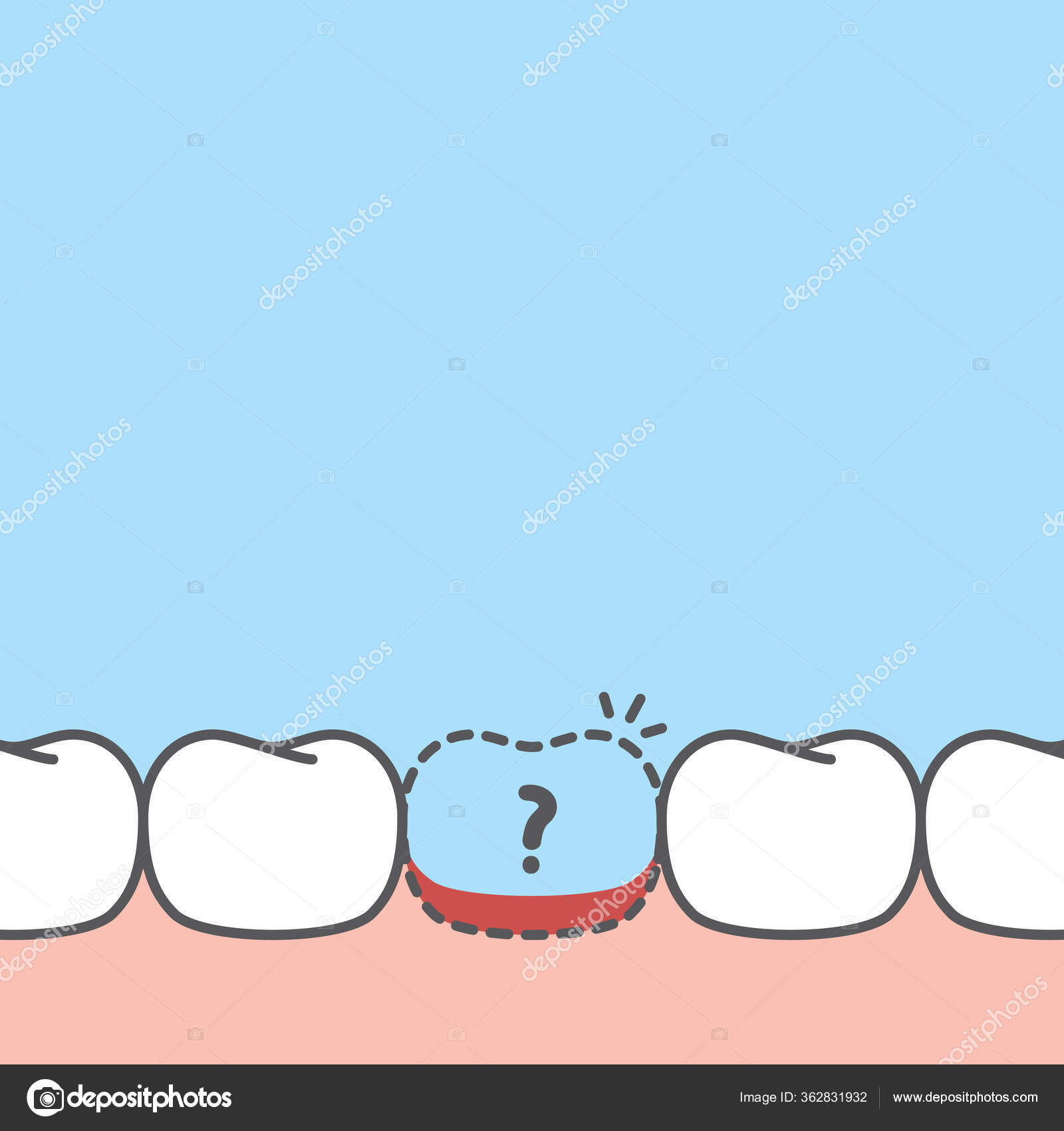 Blank Banner Lost Tooth Illustration Vector Design Blue Background ...