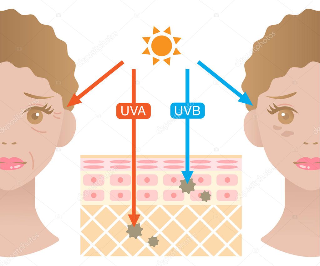 ilustración infográfica de la diferencia entre los rayos UVA y UVB. penetración UV en la piel ...
