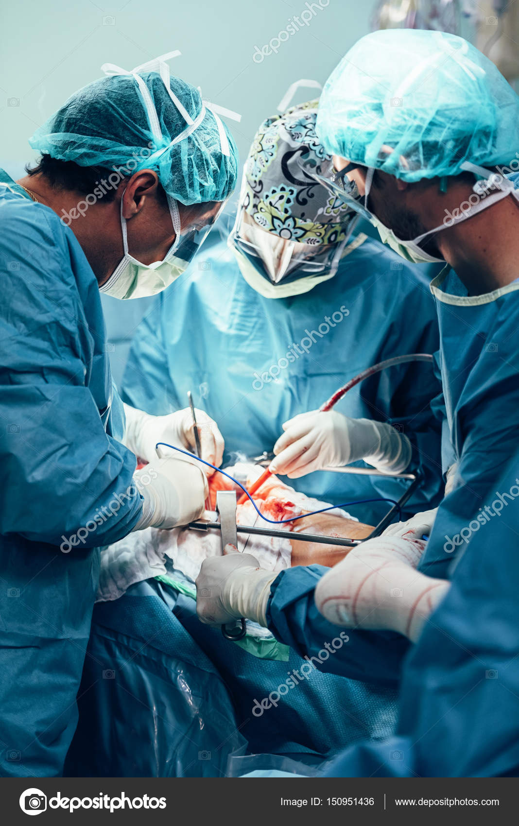 Team of Surgeons Operating. — Stock Photo © santypan #150951436