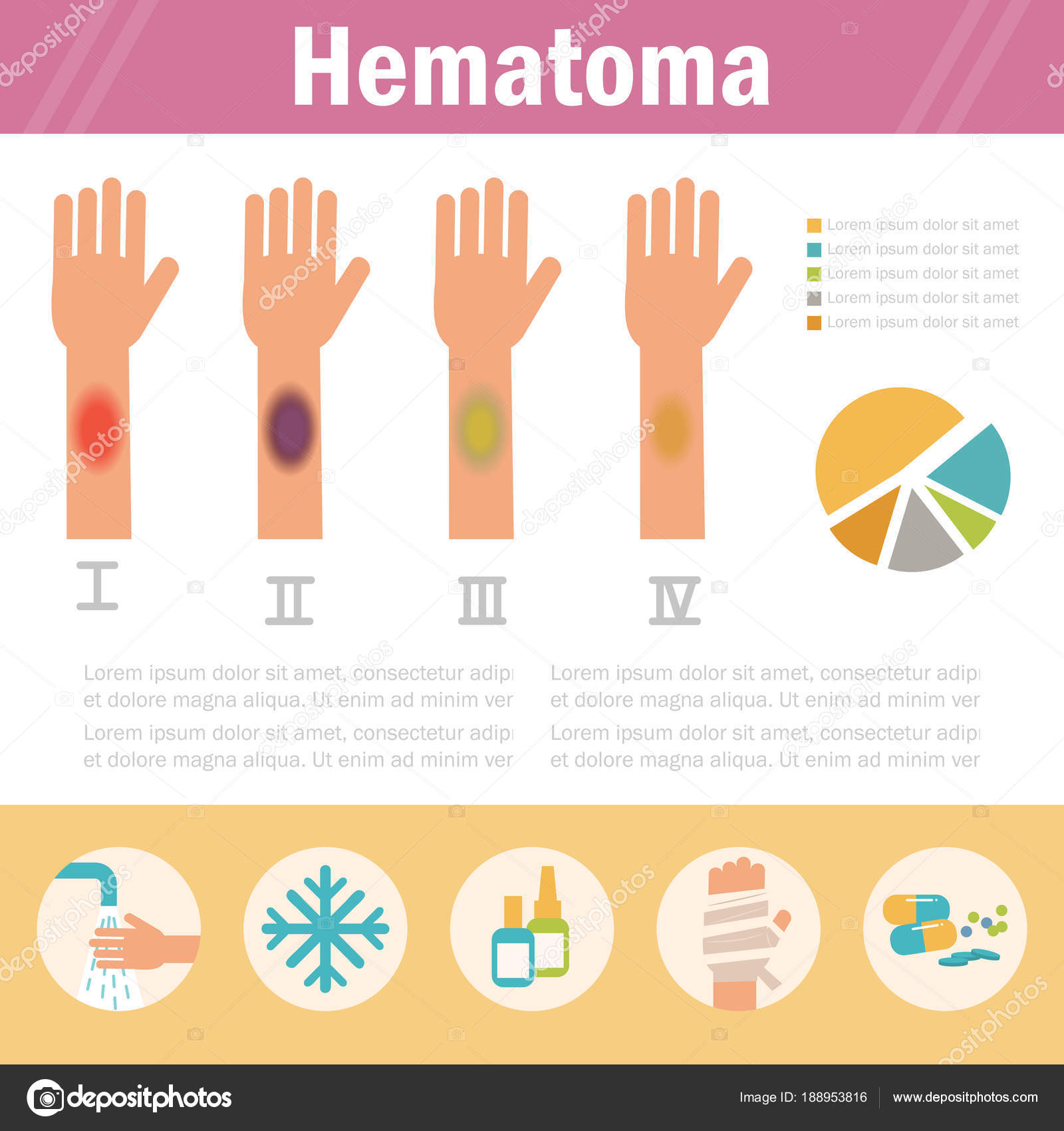 Hématome. Des étapes. Isolé image vectorielle par AnnaViolet ...