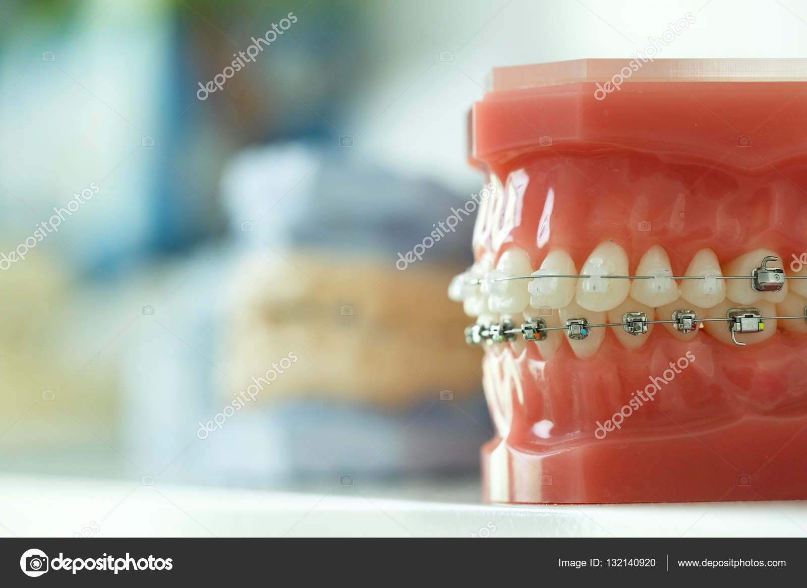 Model of human jaw with wire braces attached Stock Photo by ©zlikovec ...