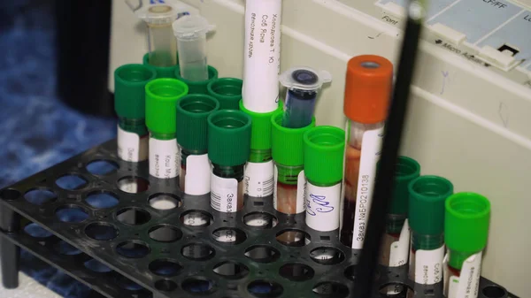 Allergen testing Stock Photos, Royalty Free Allergen testing Images ...