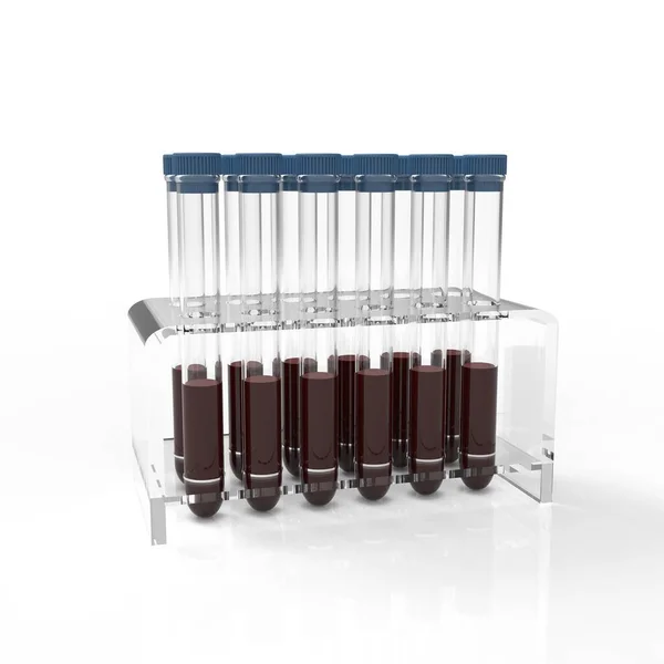 Blood vials rack Stock Photos, Royalty Free Blood vials rack Images ...