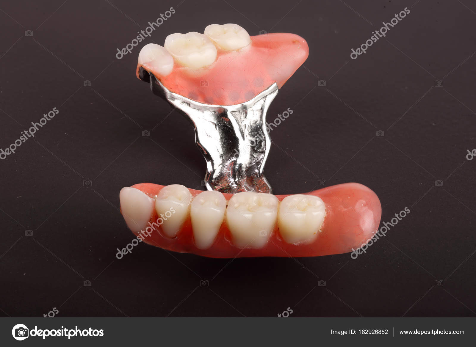 Clasp prosthesis with lock fixation on black background macro Stock ...