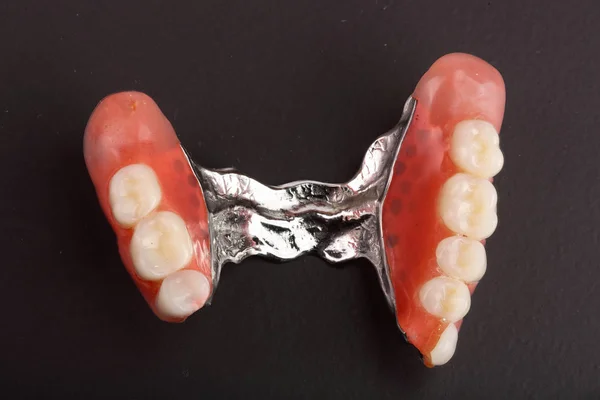 Clasp prosthesis with lock fixation on black background macro Stock ...