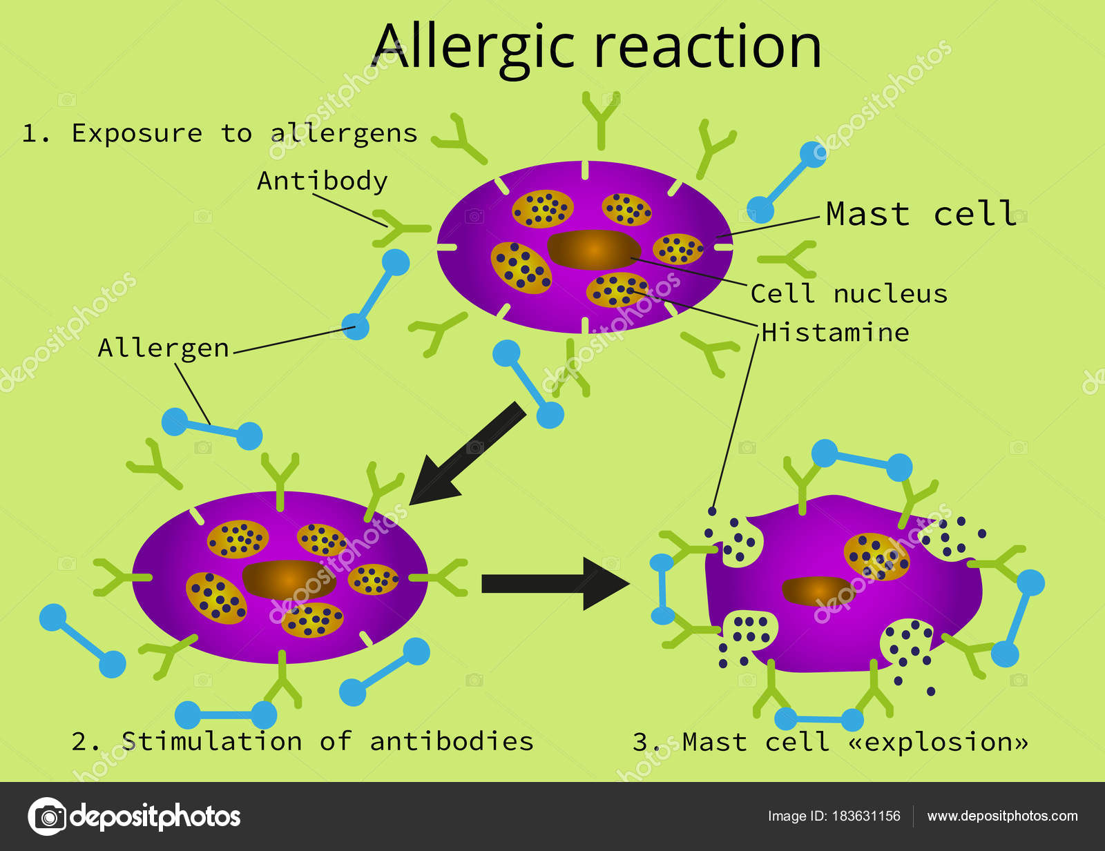 Allergic Reaction Diagram